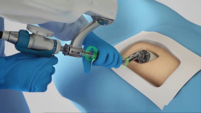 Latest Technologies in Hip Replacement Surgery | Dr. Ashutosh Jadhav